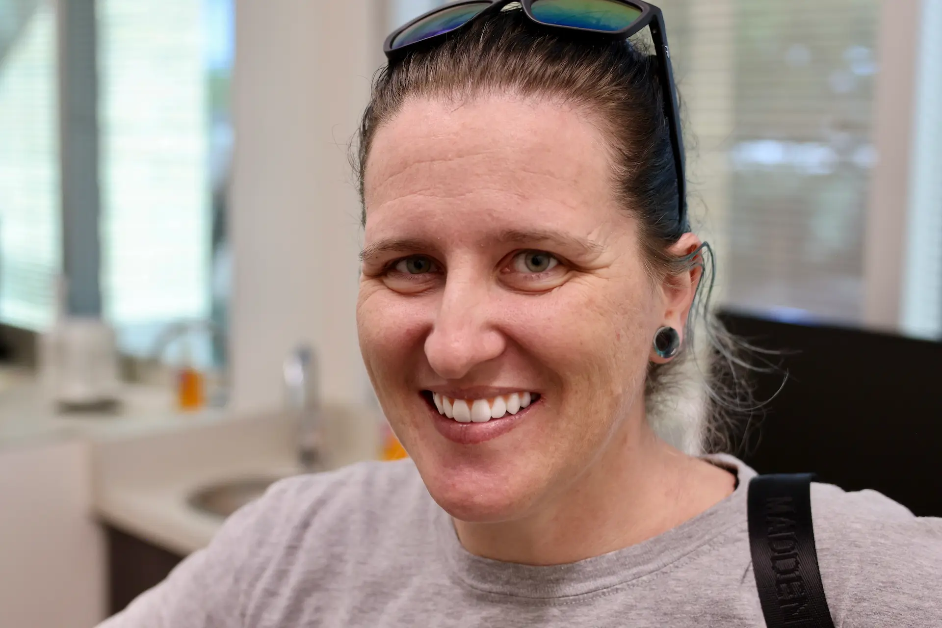 Single Arch Dental Implants | NuSet Dental